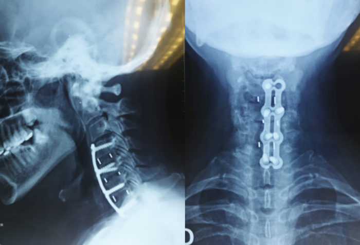 SIC Medical | Soluciones Integrales de Columna